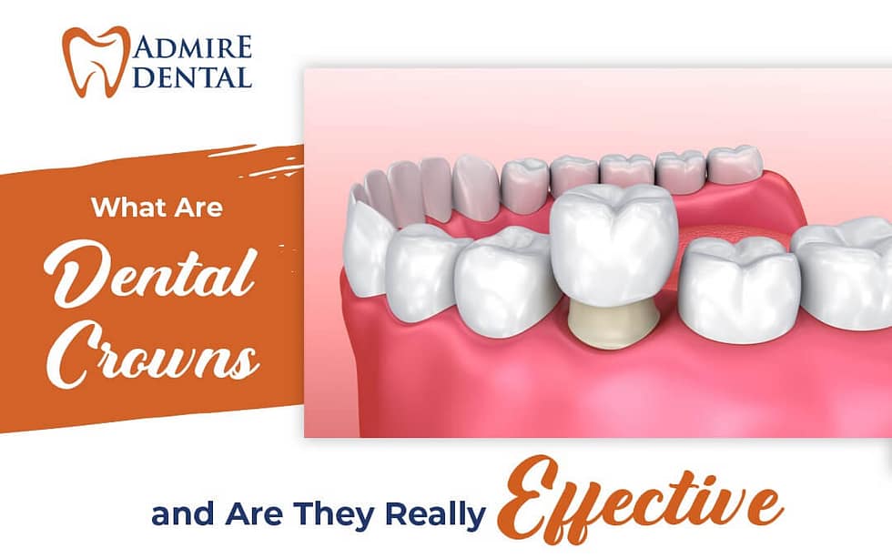Are Dental Crowns Really Effective - Complete Guide 2022